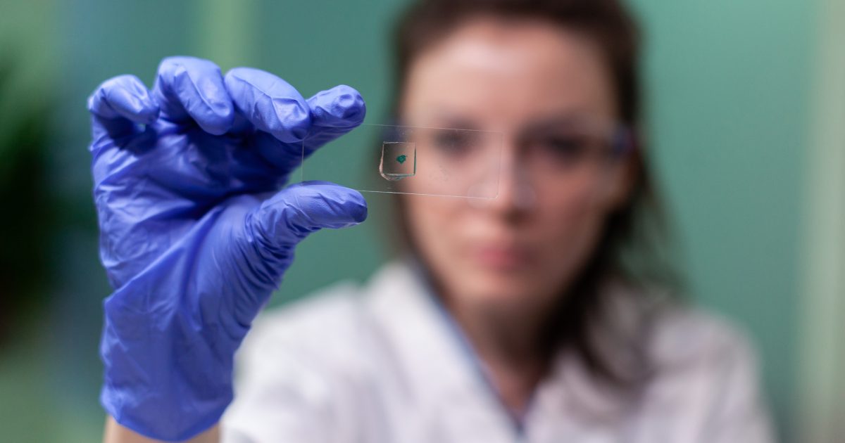 Širdies vožtuvo keitimas be pjūvio krūtinėje: moderni išeitis ...